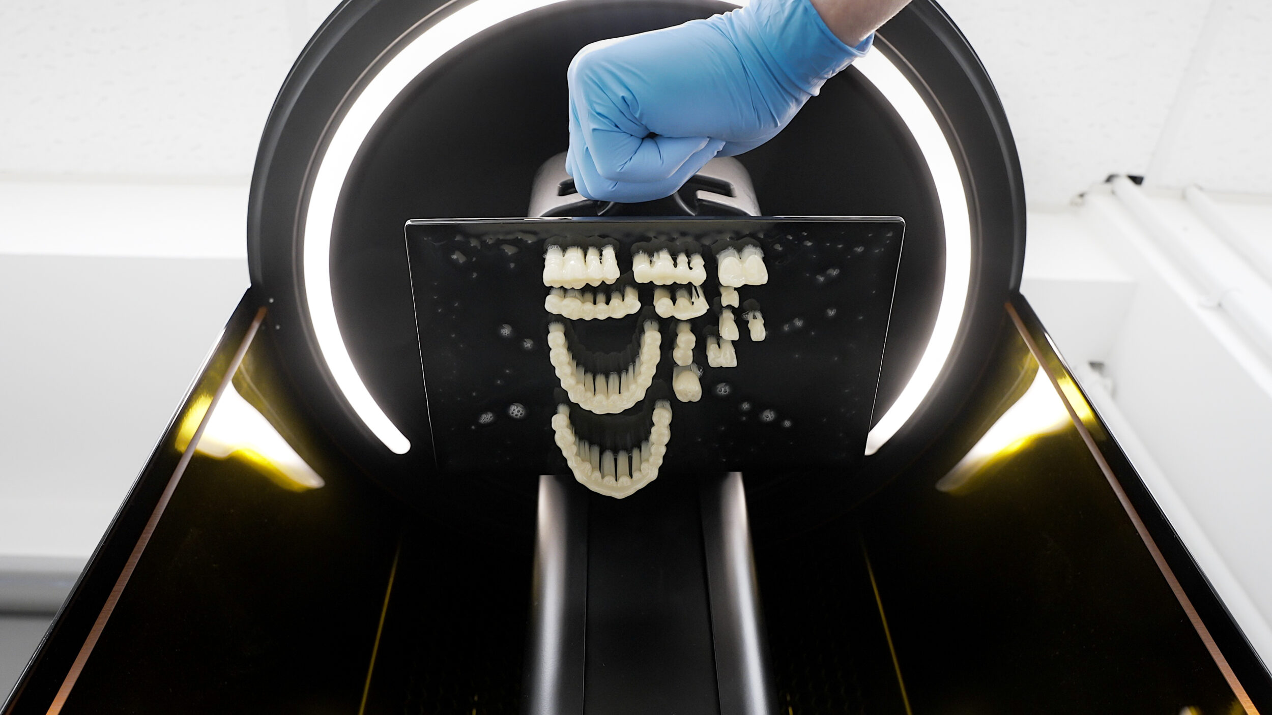 Dentuvo Digital Dentures - ALS Dental