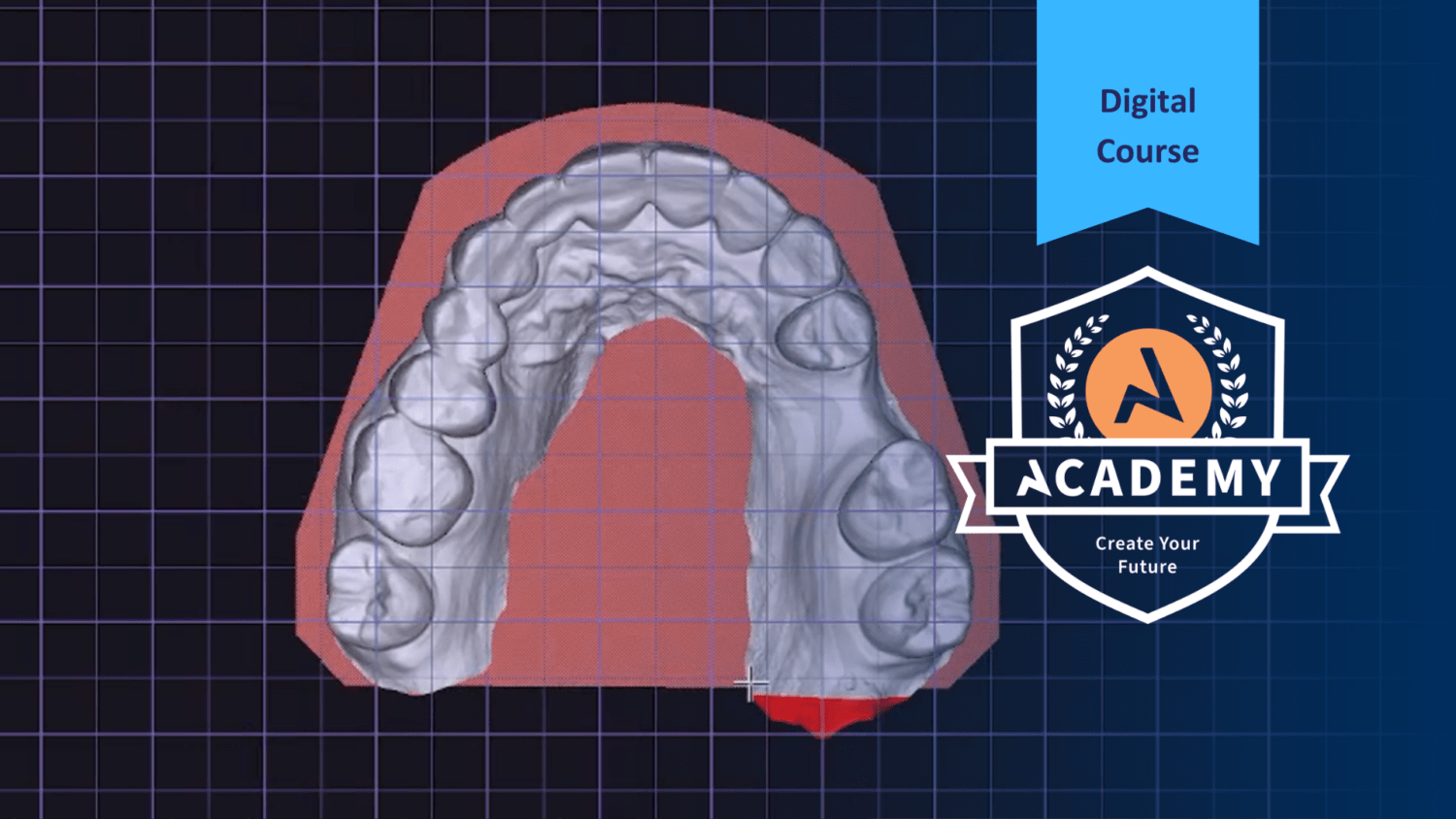 Study Models using Exocad & Asiga - ALS Dental