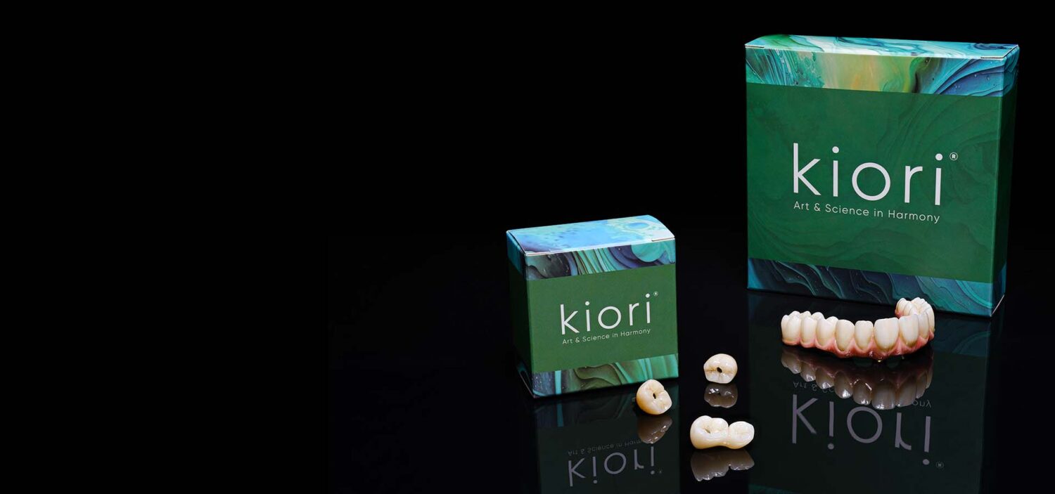 Kiori Crown - ALS Dental