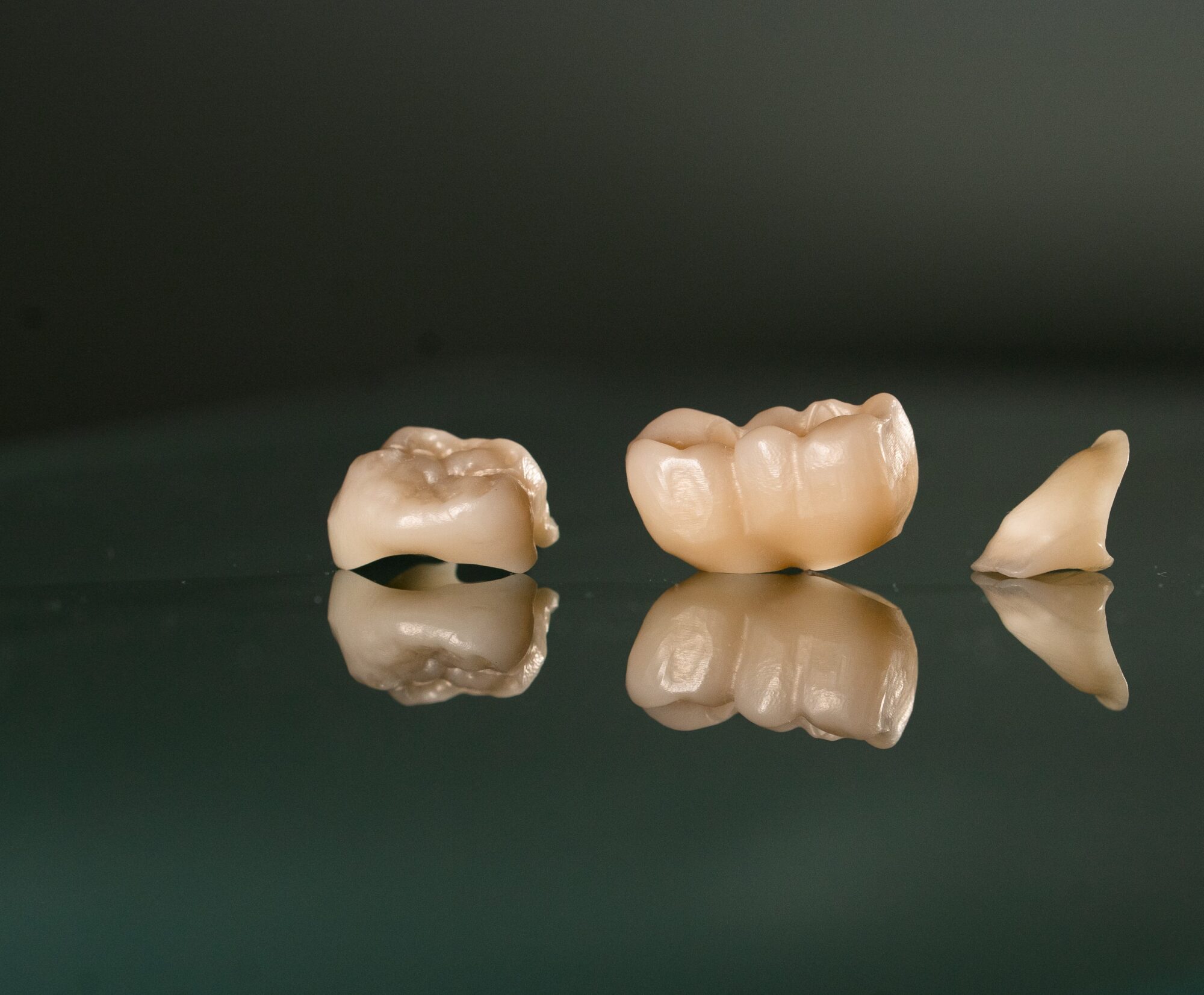 Kiori Crown - ALS Dental