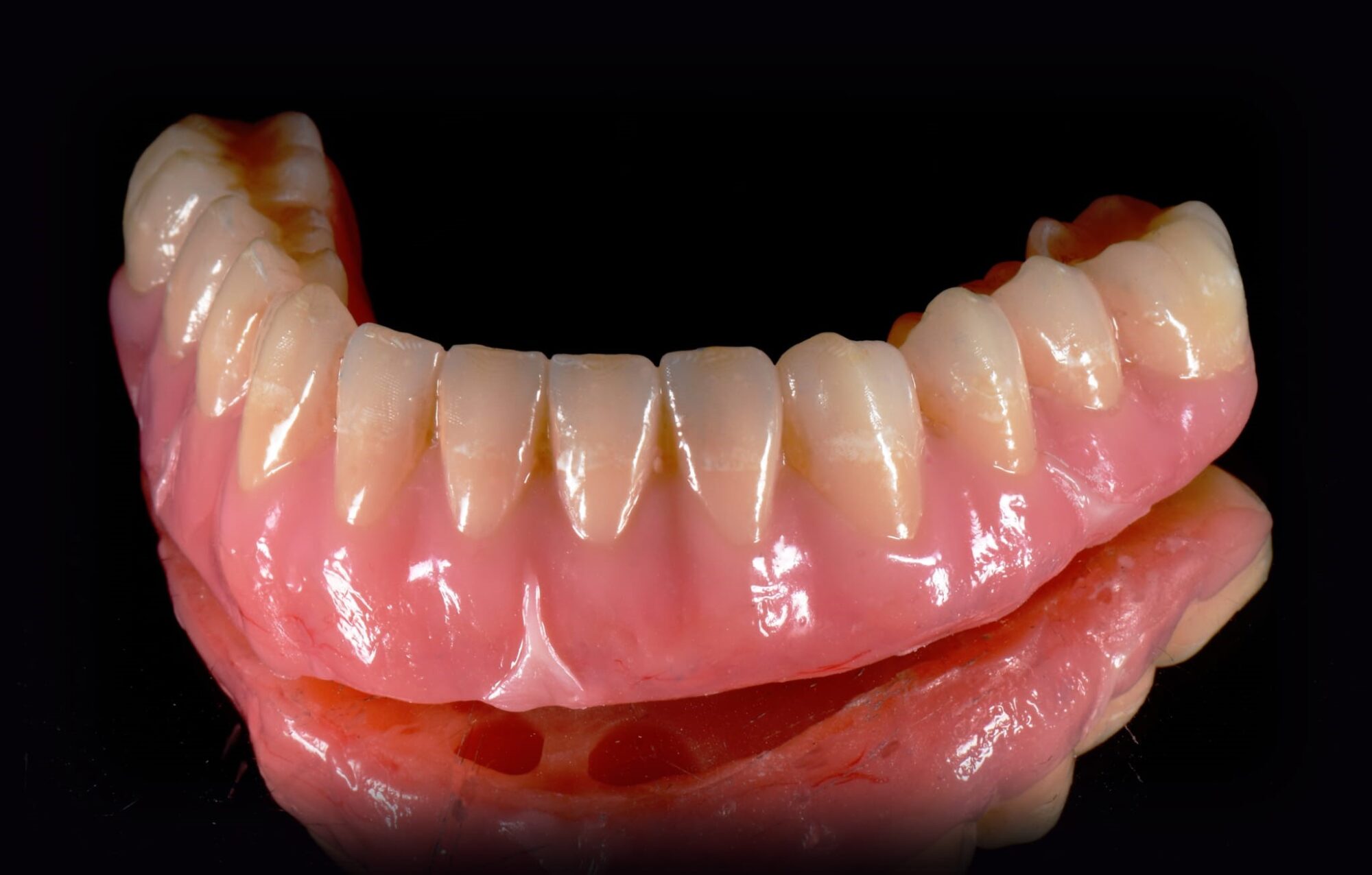 Styling up full arches with Staining and TWiNY Composite - ALS Dental