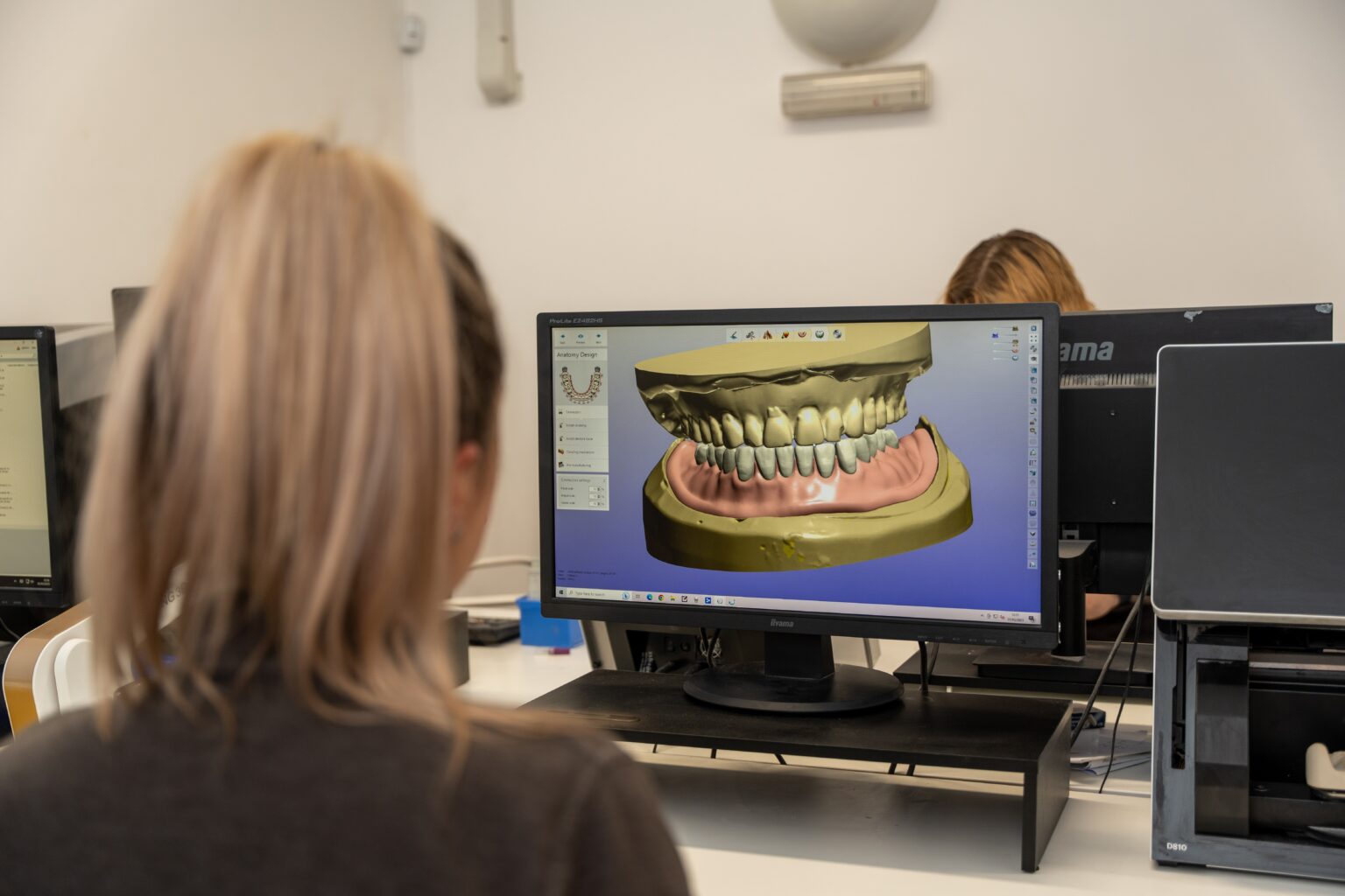 Dentuvo Platinum - ALS Dental