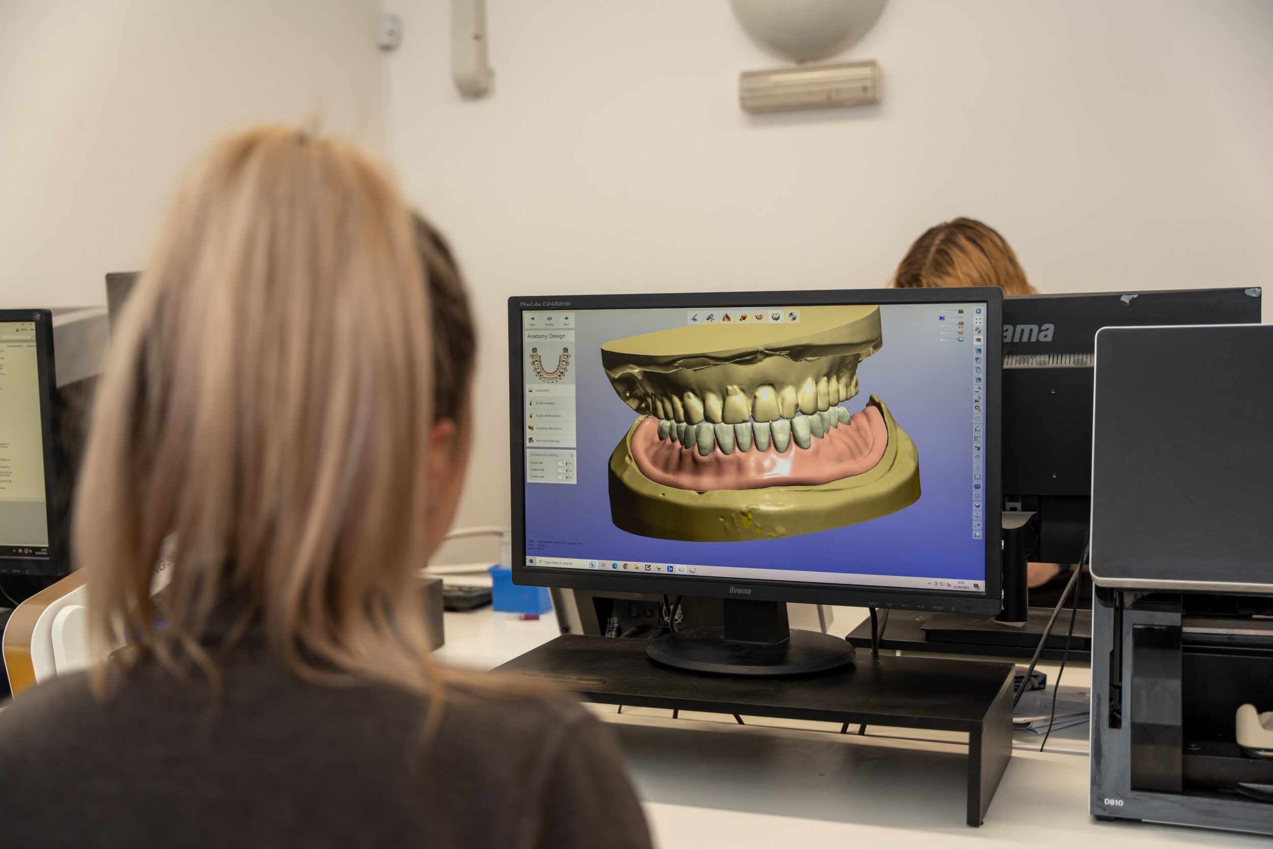 Dentuvo Platinum - ALS Dental