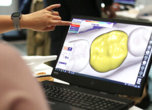 Bristol Cad/Cam | Dental Laboratory | ALS Group