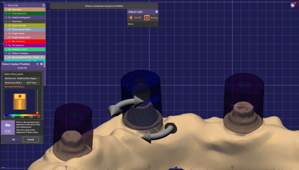 Photogrammetry in Dentistry: A Case Study from Bristol CADCAM - ALS Dental