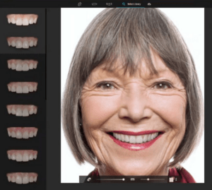 Discover Straumann Smile Cloud - ALS Dental